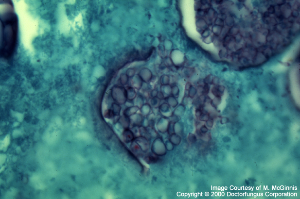 Histopathology - Doctor Fungus