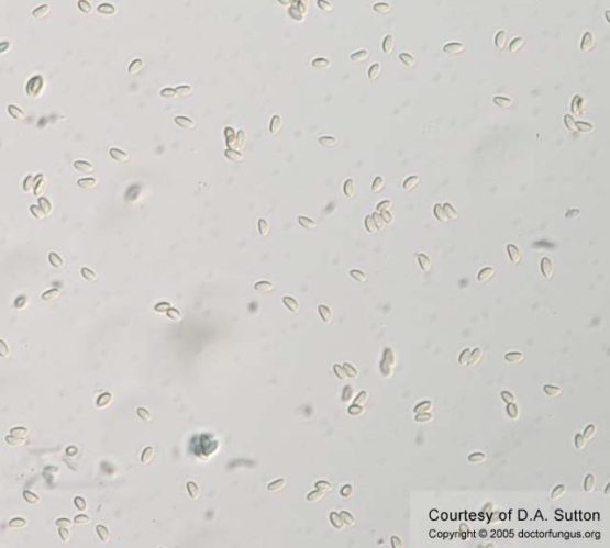 Microascus Species - Doctor Fungus