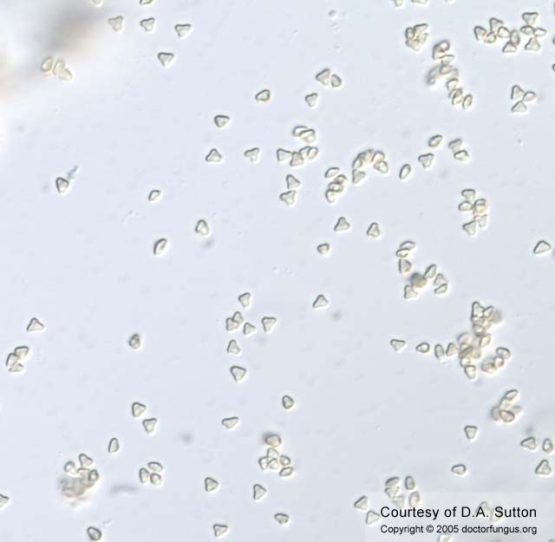 Microascus Species - Doctor Fungus