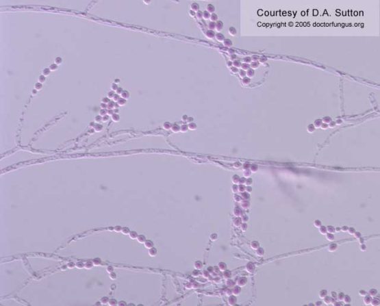 Scopulariopsis Species - Doctor Fungus