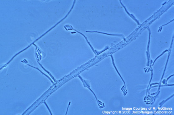 acre_l2 - Doctor Fungus