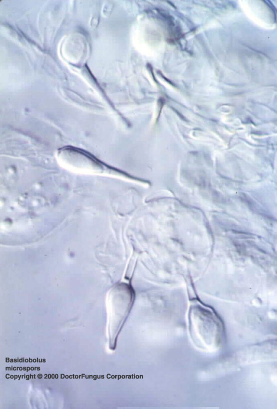 Basidiobolus Species - Doctor Fungus