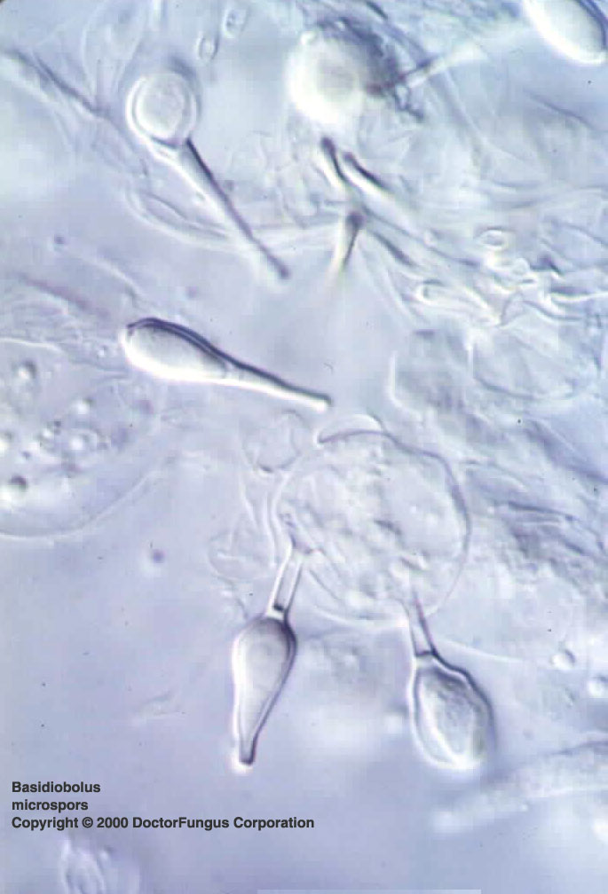 Basidiobolus Species - Doctor Fungus