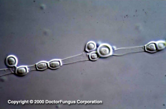 Chrysosporium Species - Doctor Fungus