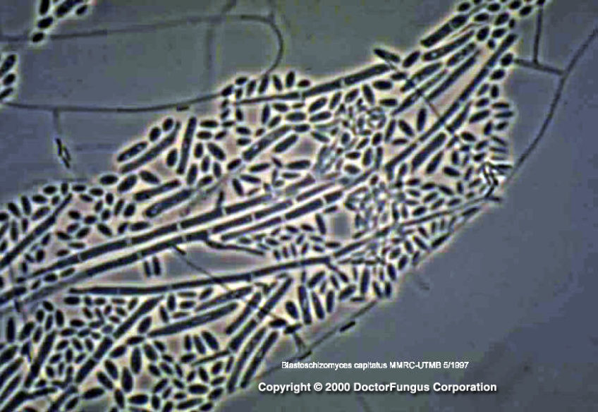 Geotrichum Species - Doctor Fungus