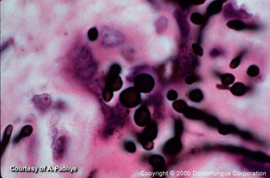 he_gms_phaeo_e_spinifera - Doctor Fungus