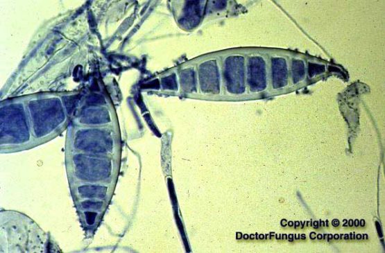 Microsporum canis - Doctor Fungus