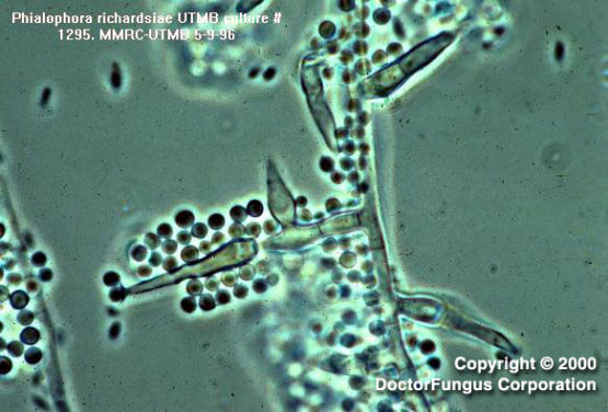 Phialophora Species - Doctor Fungus