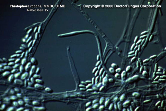Phialophora Species - Doctor Fungus
