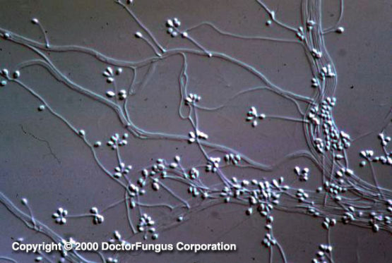 Sporothrix Species - Doctor Fungus