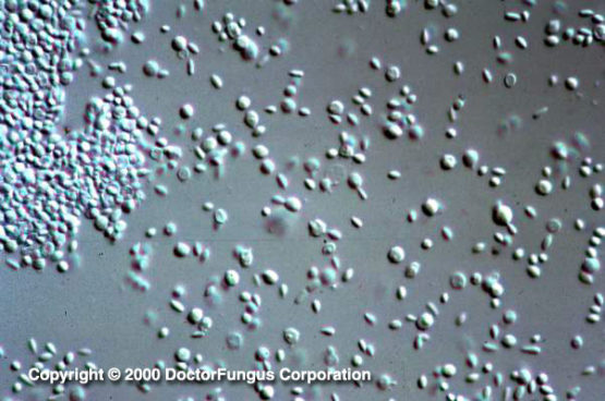 Sporothrix Species - Doctor Fungus