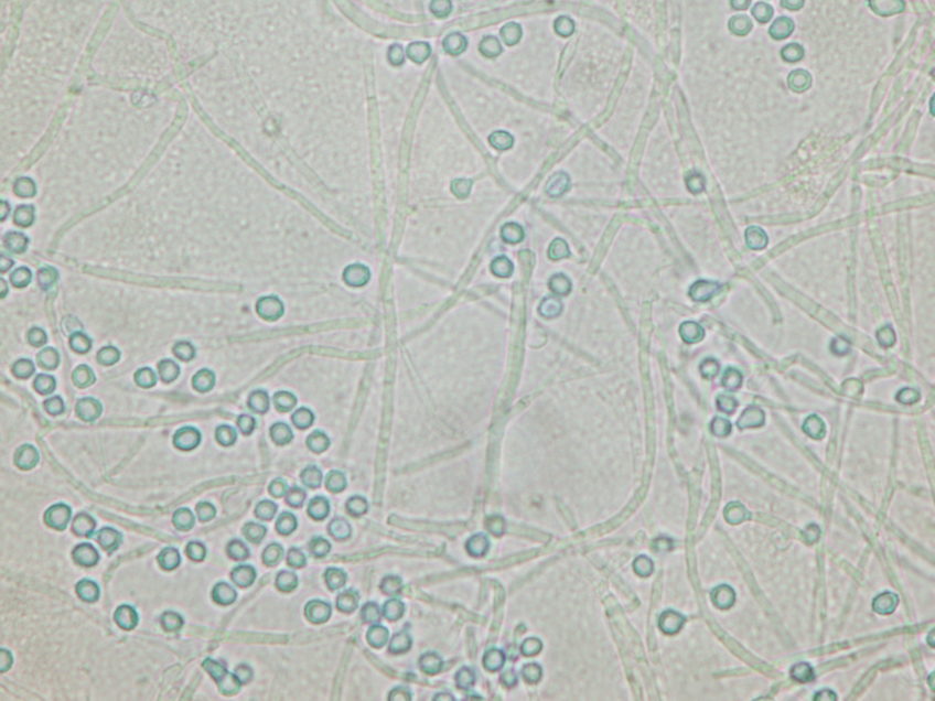 January 2019 Case of the Month - Doctor Fungus