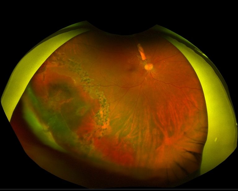 October 2019 Case of the Month - Doctor Fungus