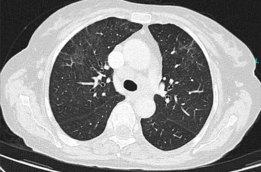 August 2020 Case of the Month - Doctor Fungus