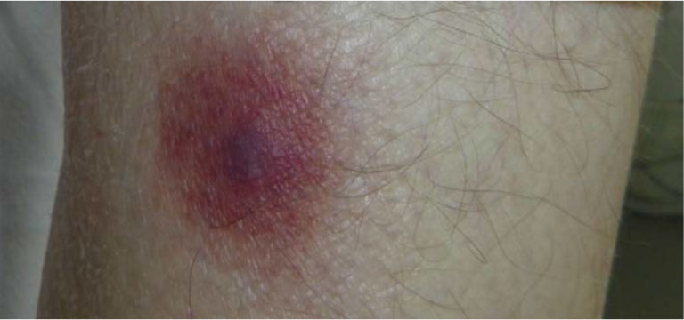 October 2020 Case of the Month - Doctor Fungus