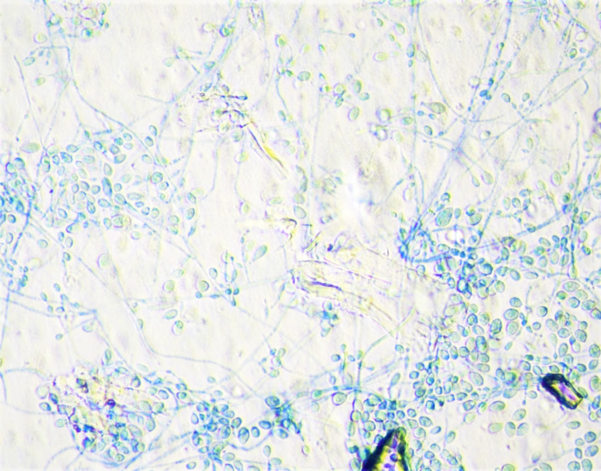 Figure-3-Lactophenol-cotton-blue-stain_5_17_2021_MN - Doctor Fungus