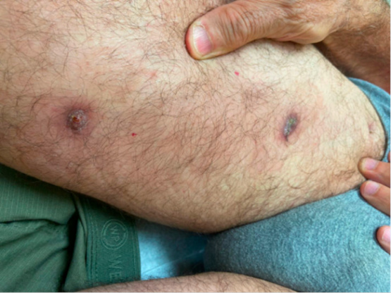June 2025 Case of the Month - Doctor Fungus