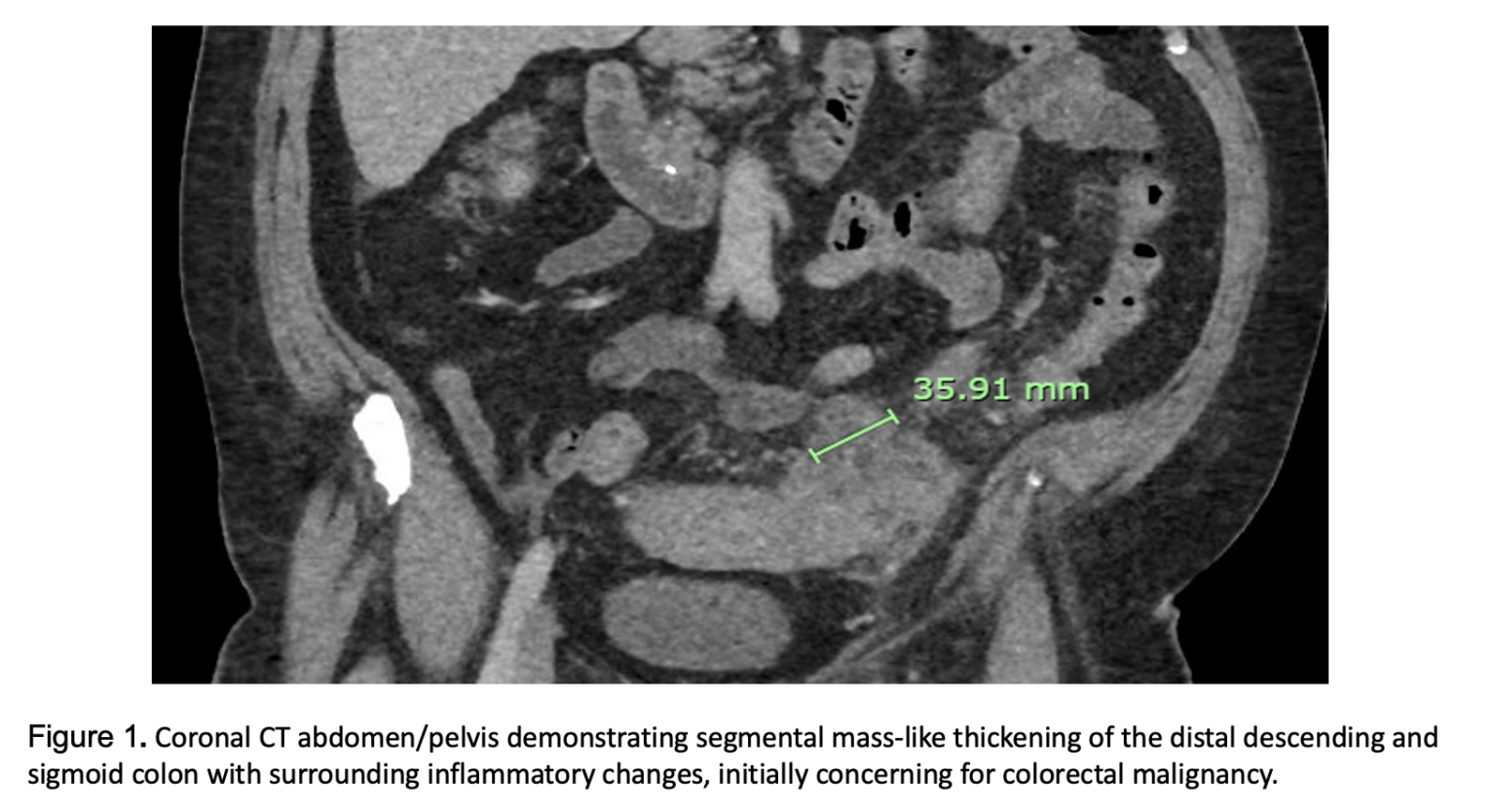 May 2026 Case of the Month - Doctor Fungus